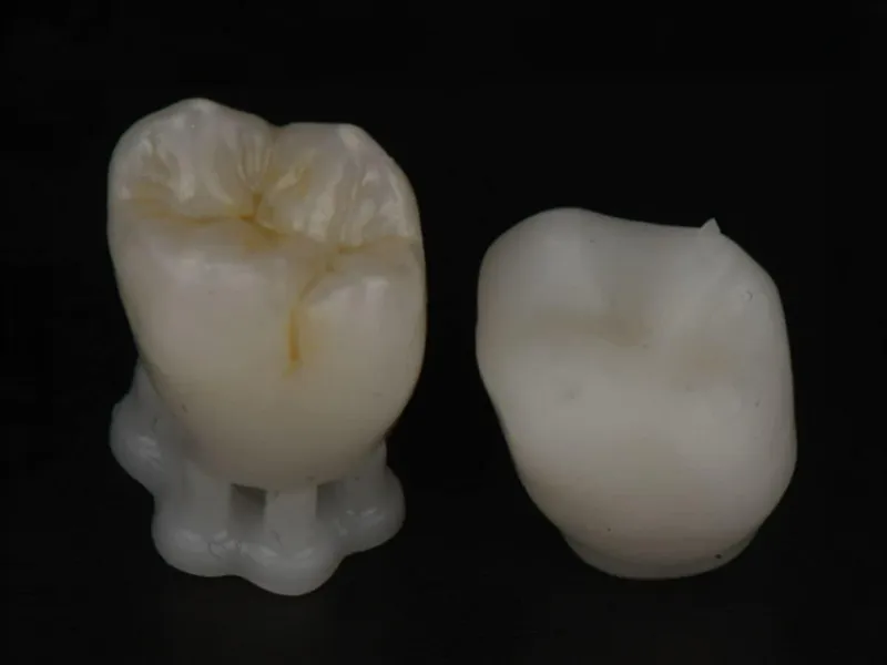 3D-Printed Dental Crowns & Partial Crowns - Australian Digital ...